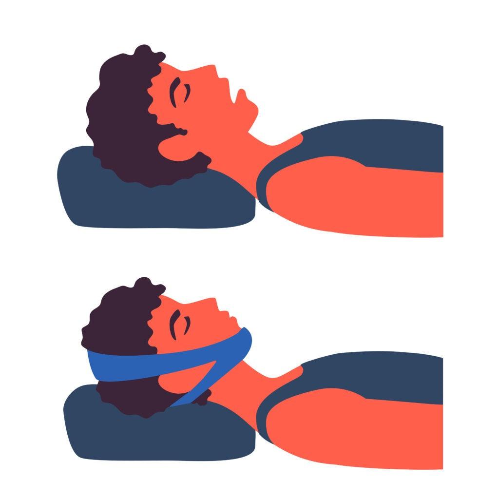 The Ultimate Buying Guide: Finding Your Best CPAP Chinstrap | CPAP.com ...