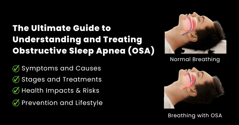 What is Obstructive Sleep Apnea? Causes, Symptoms, Risk Factors, and Treatment Options – cpap.com