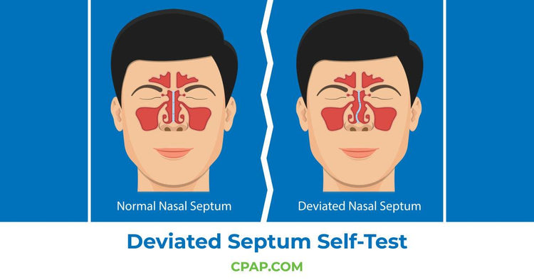 Deviated Septum Self-Test – How To Test at Home for a Deviated Septum ...