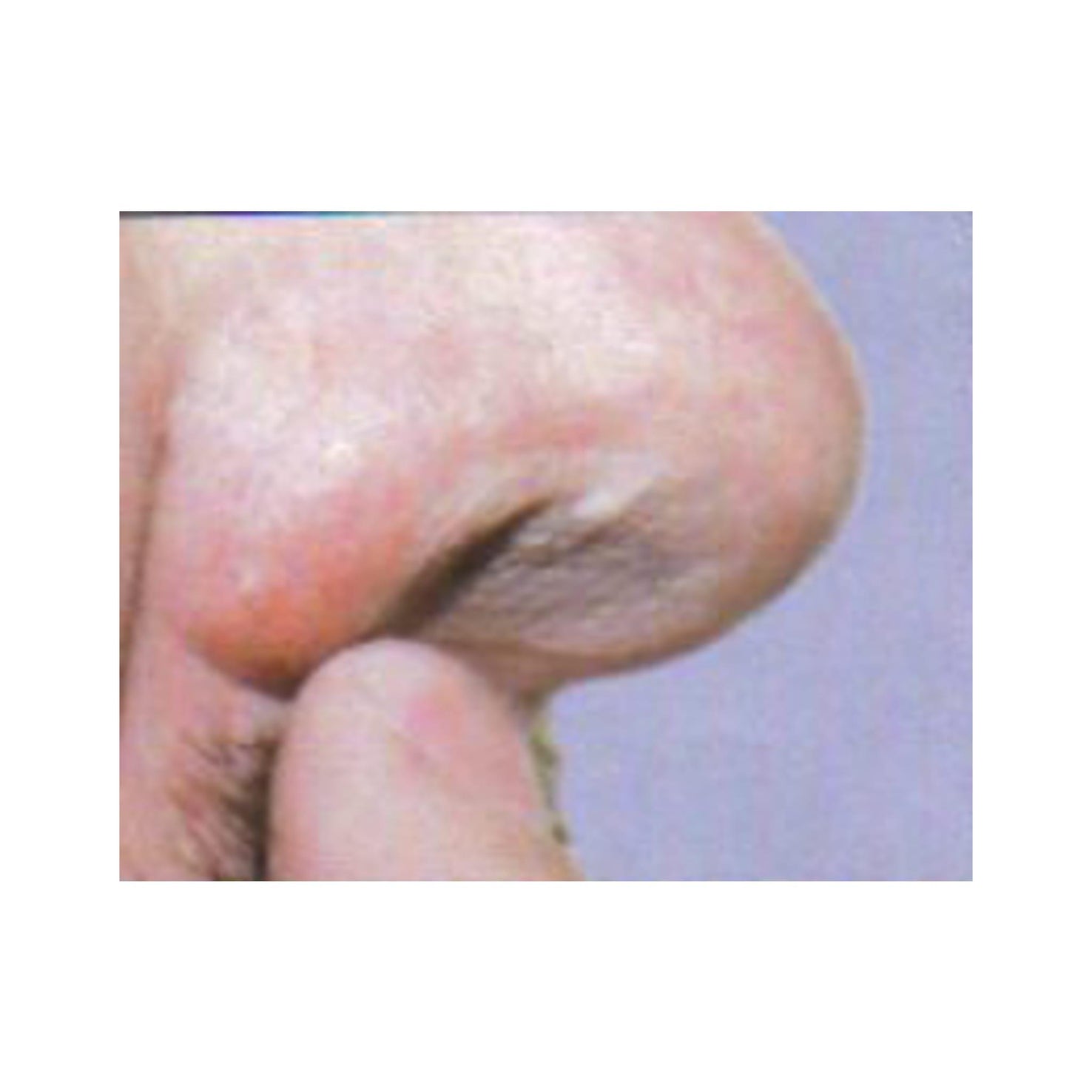 First Defense Nasal Screens – cpap.com