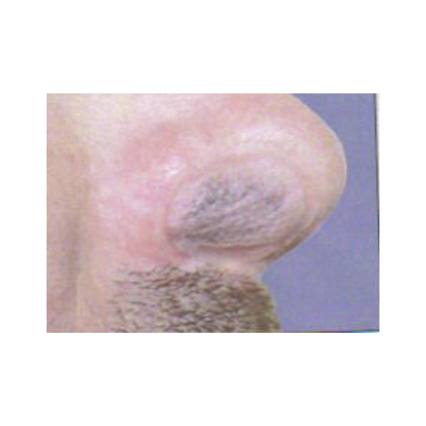 First Defense Nasal Screens – cpap.com